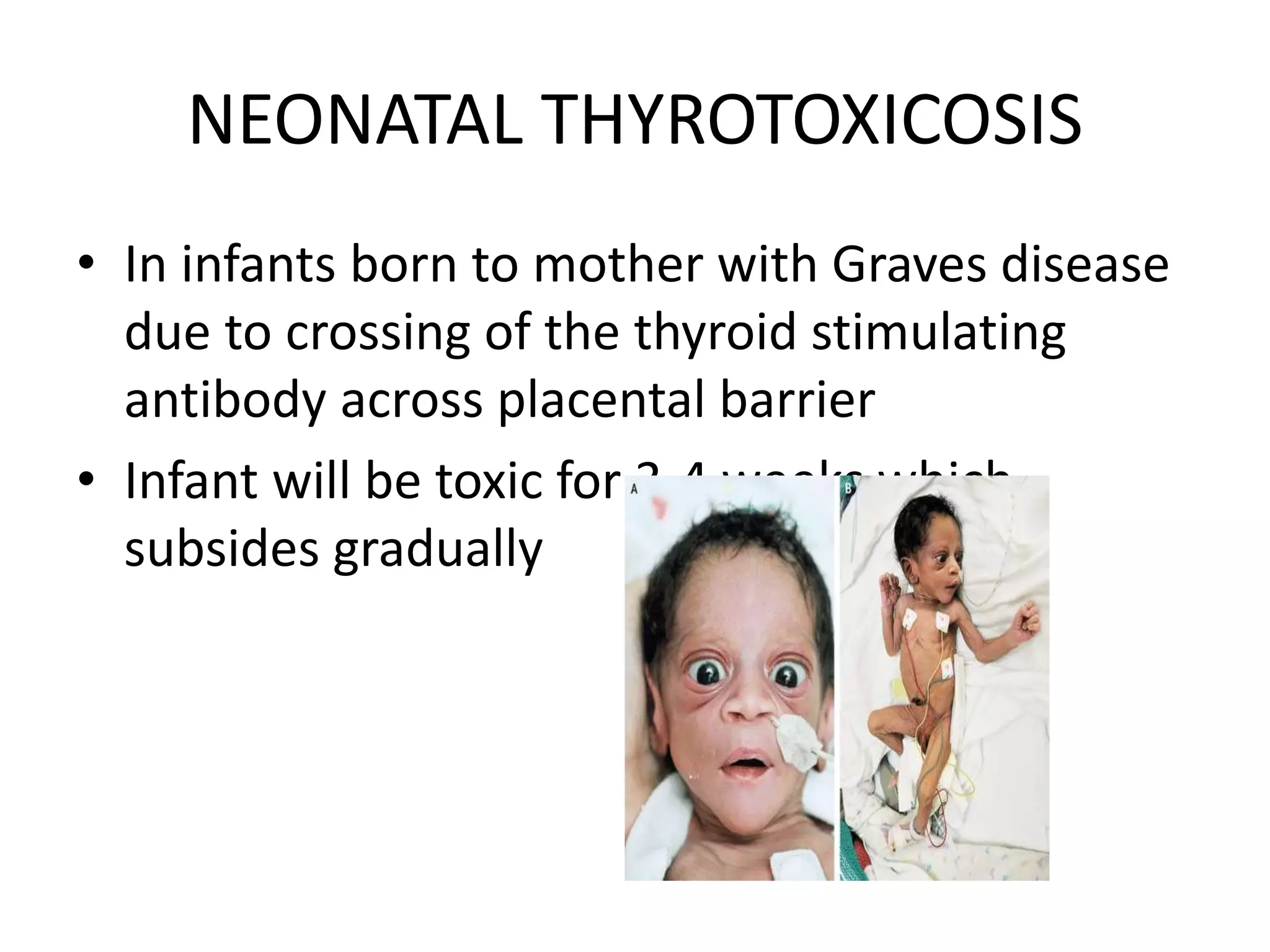 Thyrotoxicosis- complete review of anatomy, physiology, types and ...