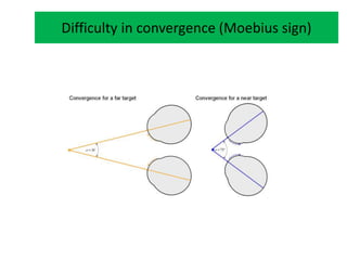 thyrotoxicosis_and_goitres.ppt