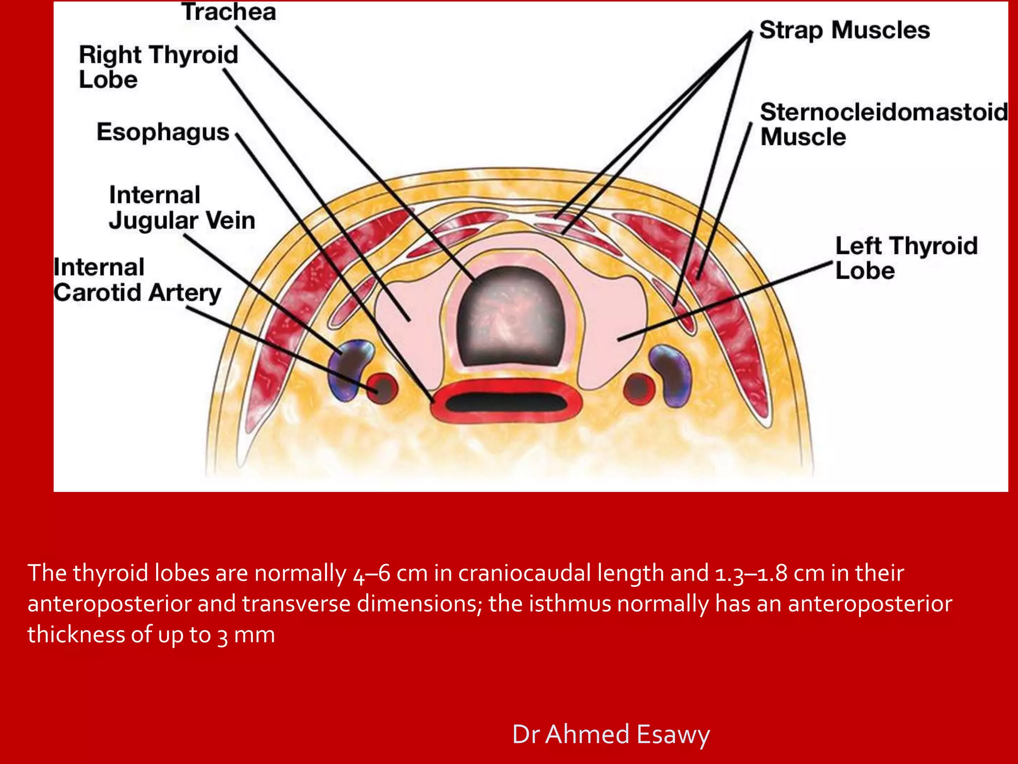 TIRADS (thyroid nodule imaging reporting and data system) Dr Ahmed ...