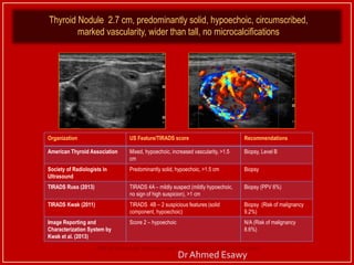 TIRADS (thyroid nodule imaging reporting and data system) Dr Ahmed ...
