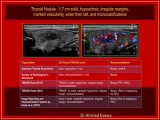 TIRADS (thyroid nodule imaging reporting and data system) Dr Ahmed ...