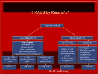 TIRADS (thyroid nodule imaging reporting and data system) Dr Ahmed ...