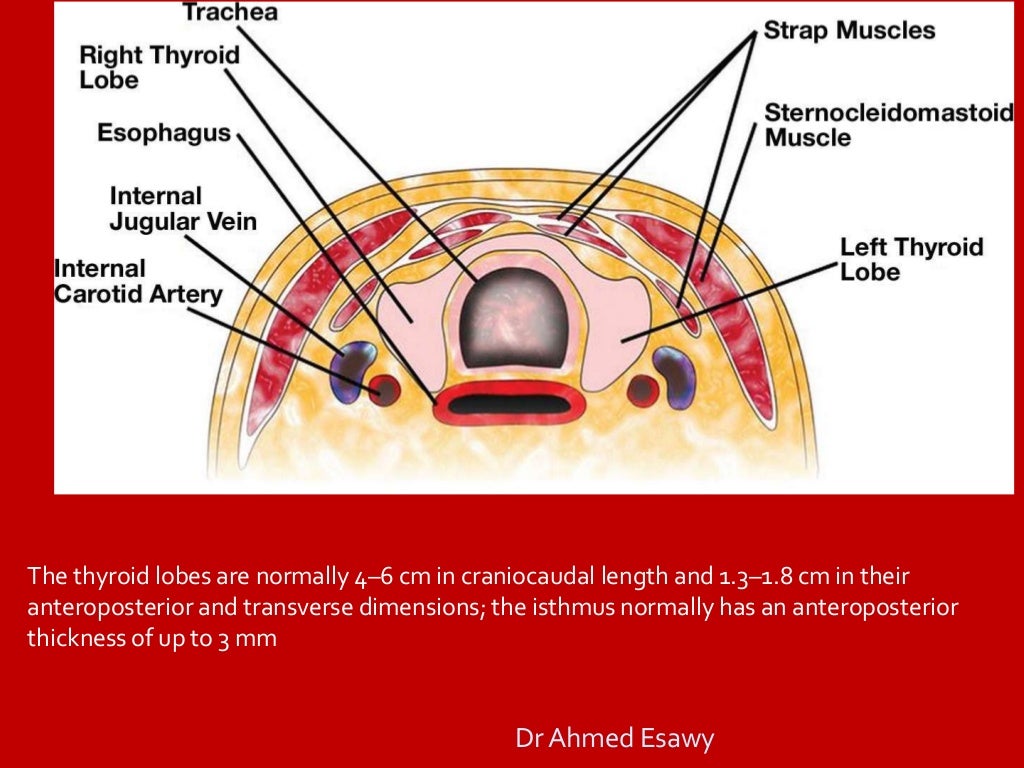TIRADS (thyroid nodule imaging reporting and data system) Dr Ahmed E…