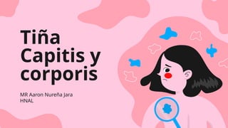 Tiña capitis y corporis en pediatria.pptx