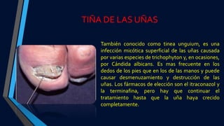 Tiña de uñas y piritiasis versicolor | PPTX