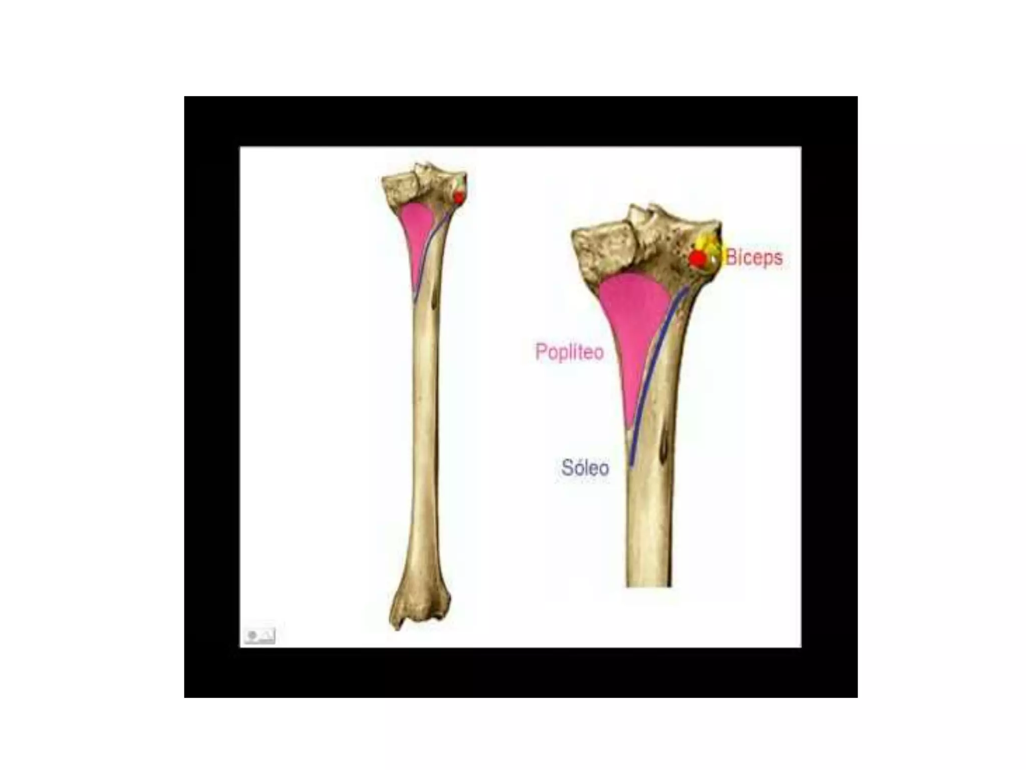 Tibia.... | PPTX