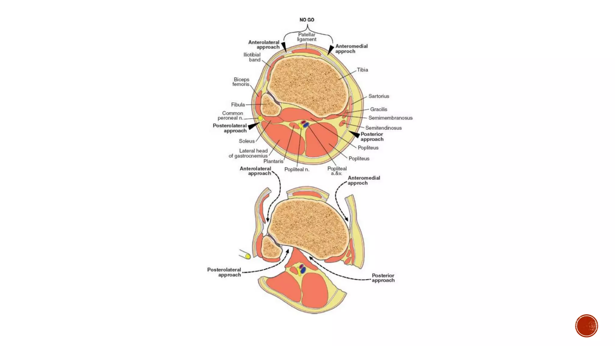 Proximal Tibia Surgical approaches | PPTX