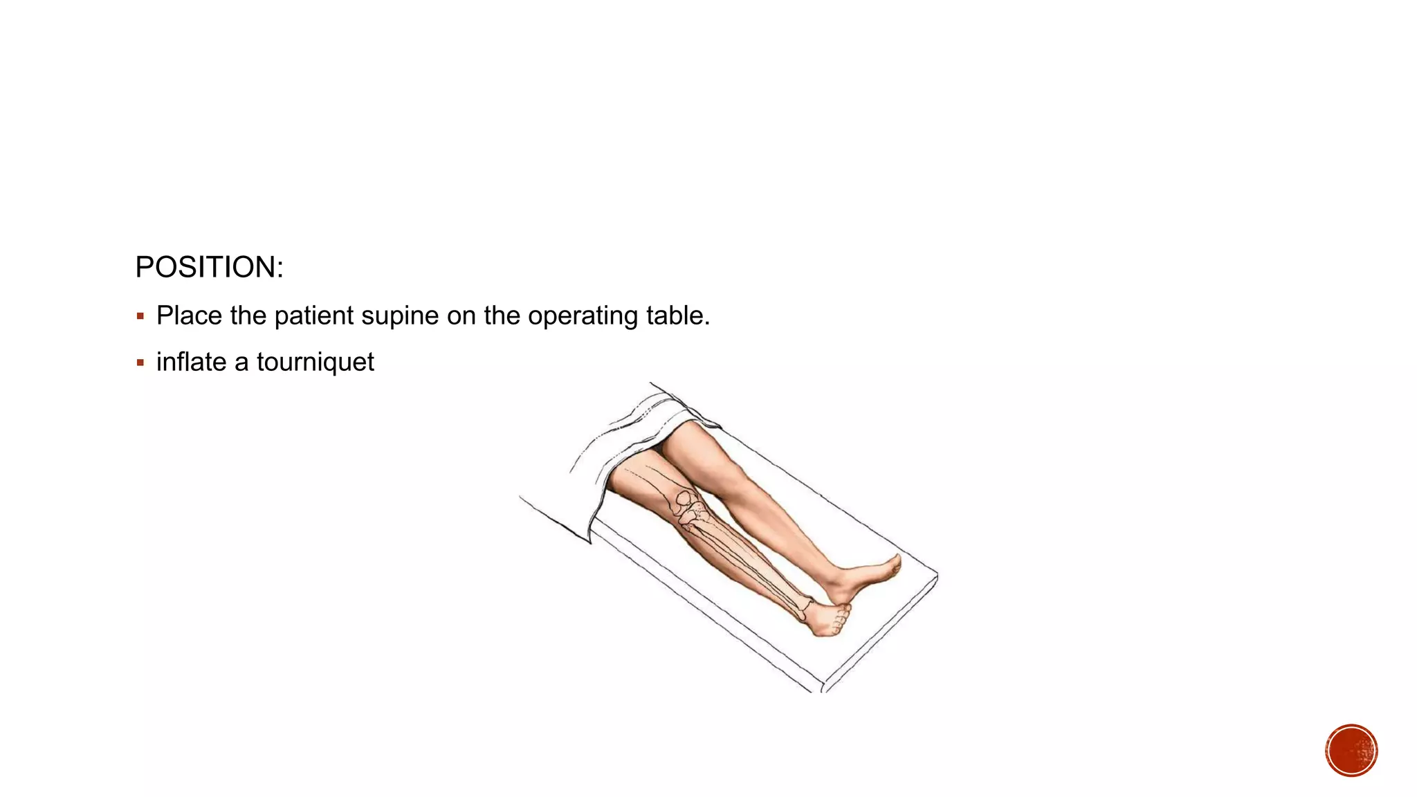 Proximal Tibia Surgical approaches | PPTX