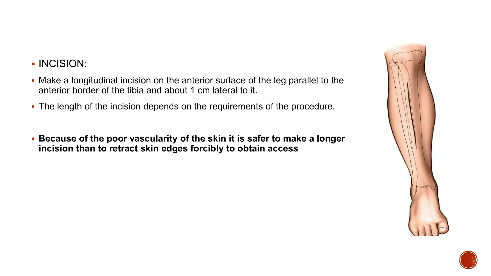 Proximal Tibia Surgical approaches | PPTX