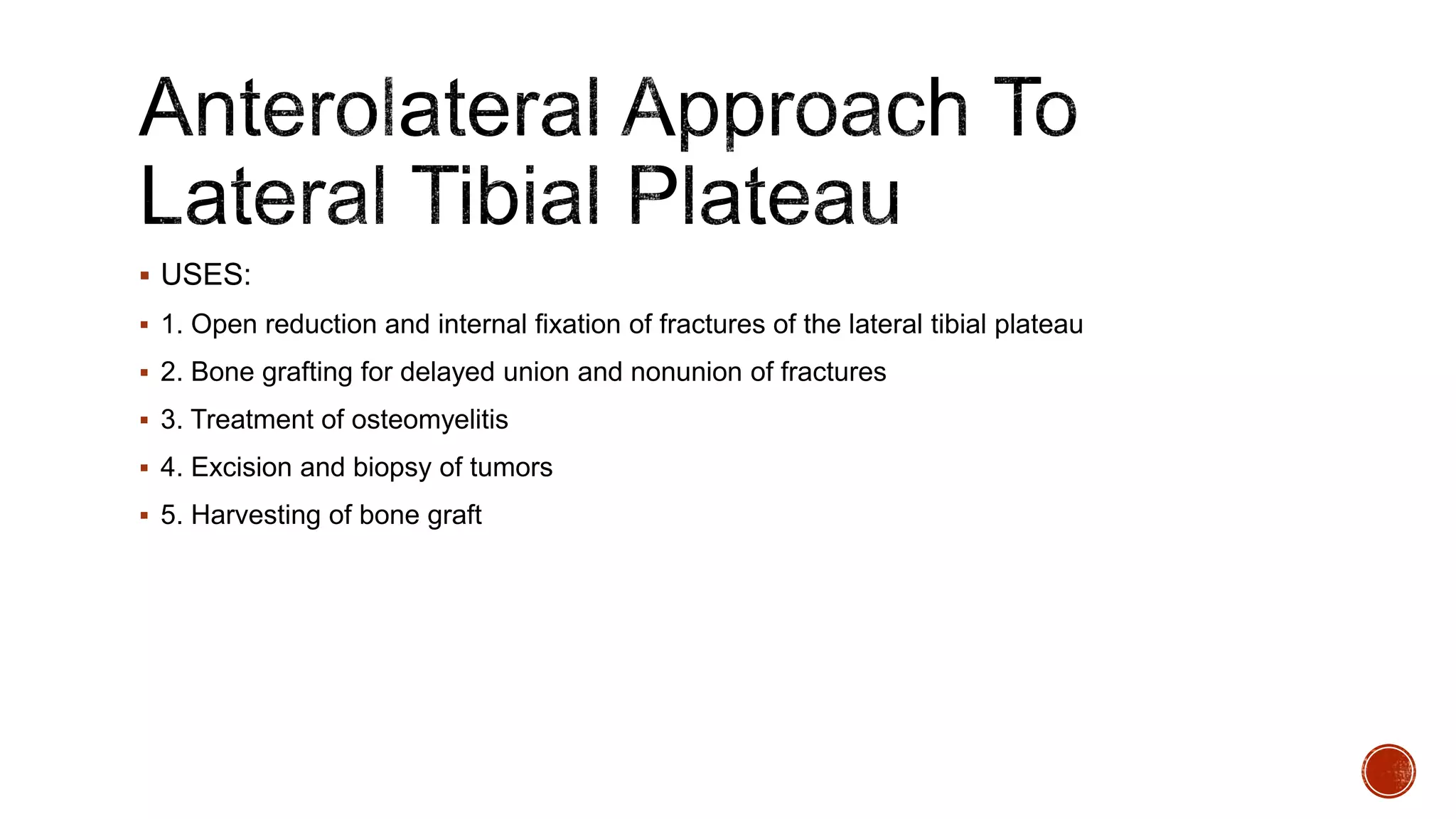 Proximal Tibia Surgical approaches | PPTX