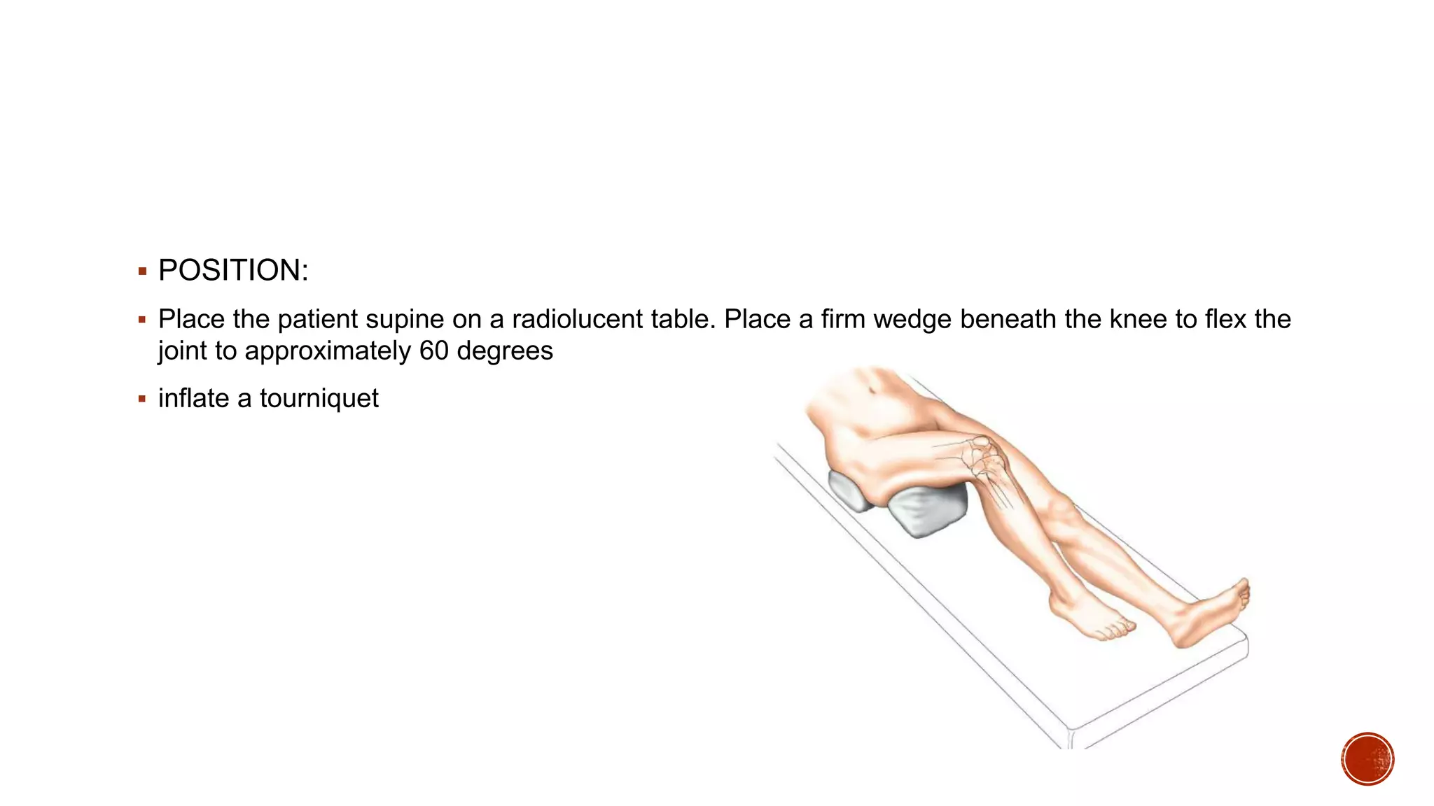 Proximal Tibia Surgical approaches | PPTX