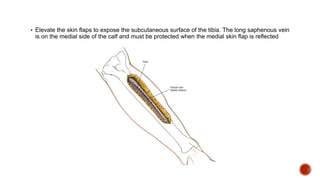 Proximal Tibia Surgical approaches | PPTX