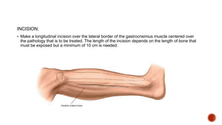 Proximal Tibia Surgical approaches | PPTX