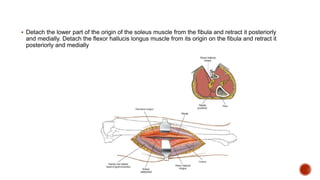 Proximal Tibia Surgical approaches | PPTX