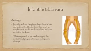 Tibial bowing and blounts disease presentation | PPT