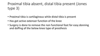 Tibial deficiency treatment & Prosthetic management (part 2).pptx