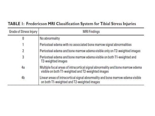 MRI in Tibial Fractures | PPTX