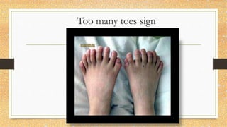 Tibialis Posterior Insufficiency.pptx