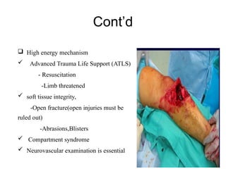 TIBIAL PLATEAU fracture power point presentation | PPTX