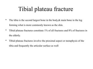TIBIAL PLATEAU fracture power point presentation | PPTX