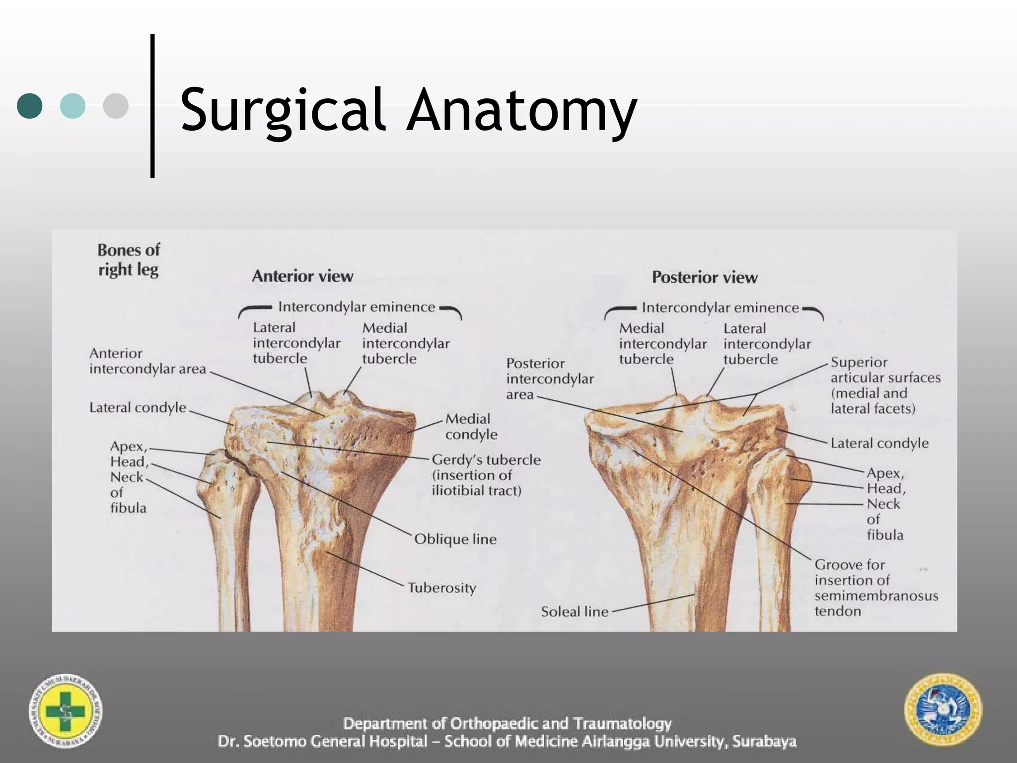Tibial plateau agf | PPT