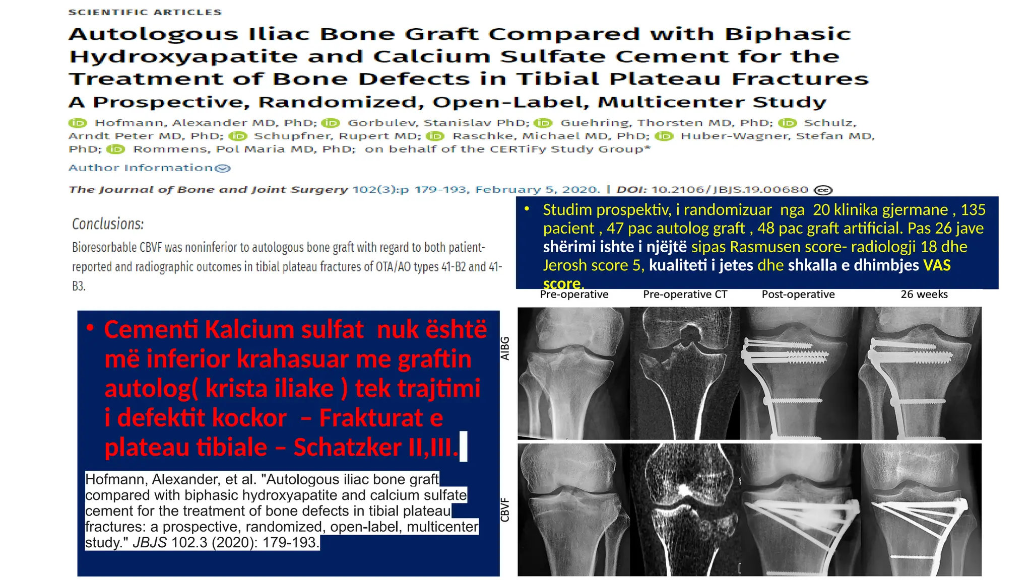 Tibial plateau fracture. Frakturat e plato tibise pptx | PPT