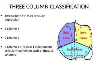 tibial plateau fracture and its management.pptx