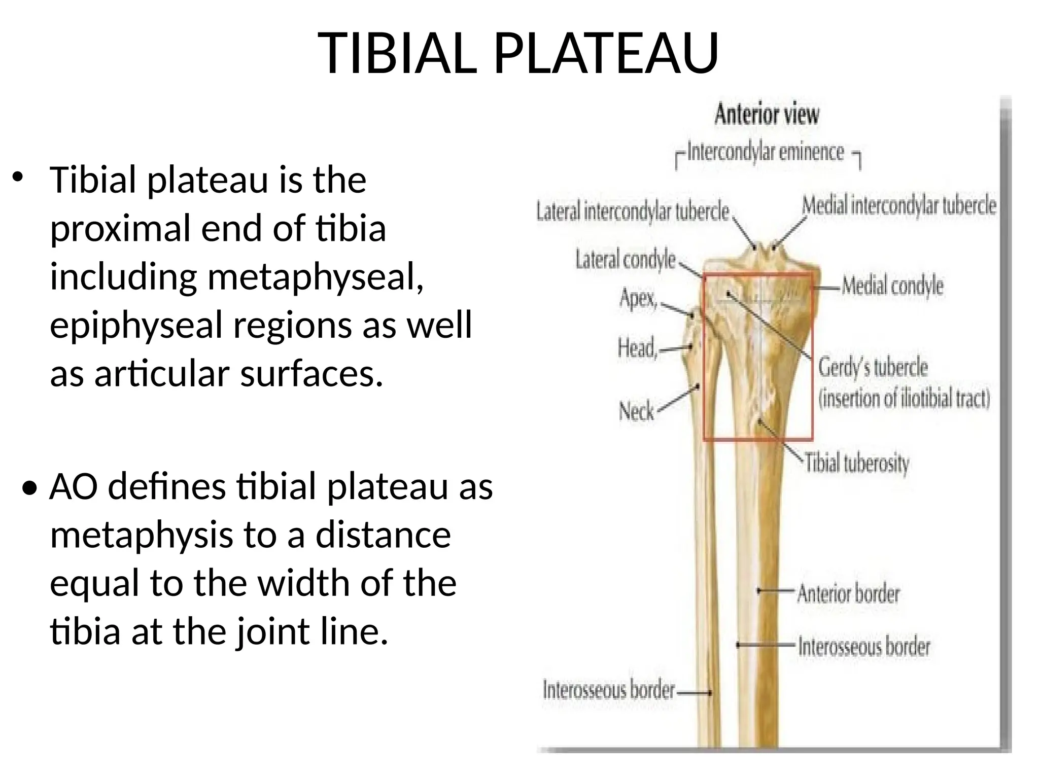 tibial plateau fracture and its management.pptx