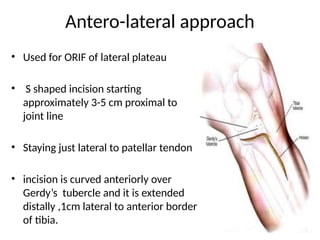 tibial plateau fracture and its management.pptx