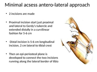 tibial plateau fracture and its management.pptx