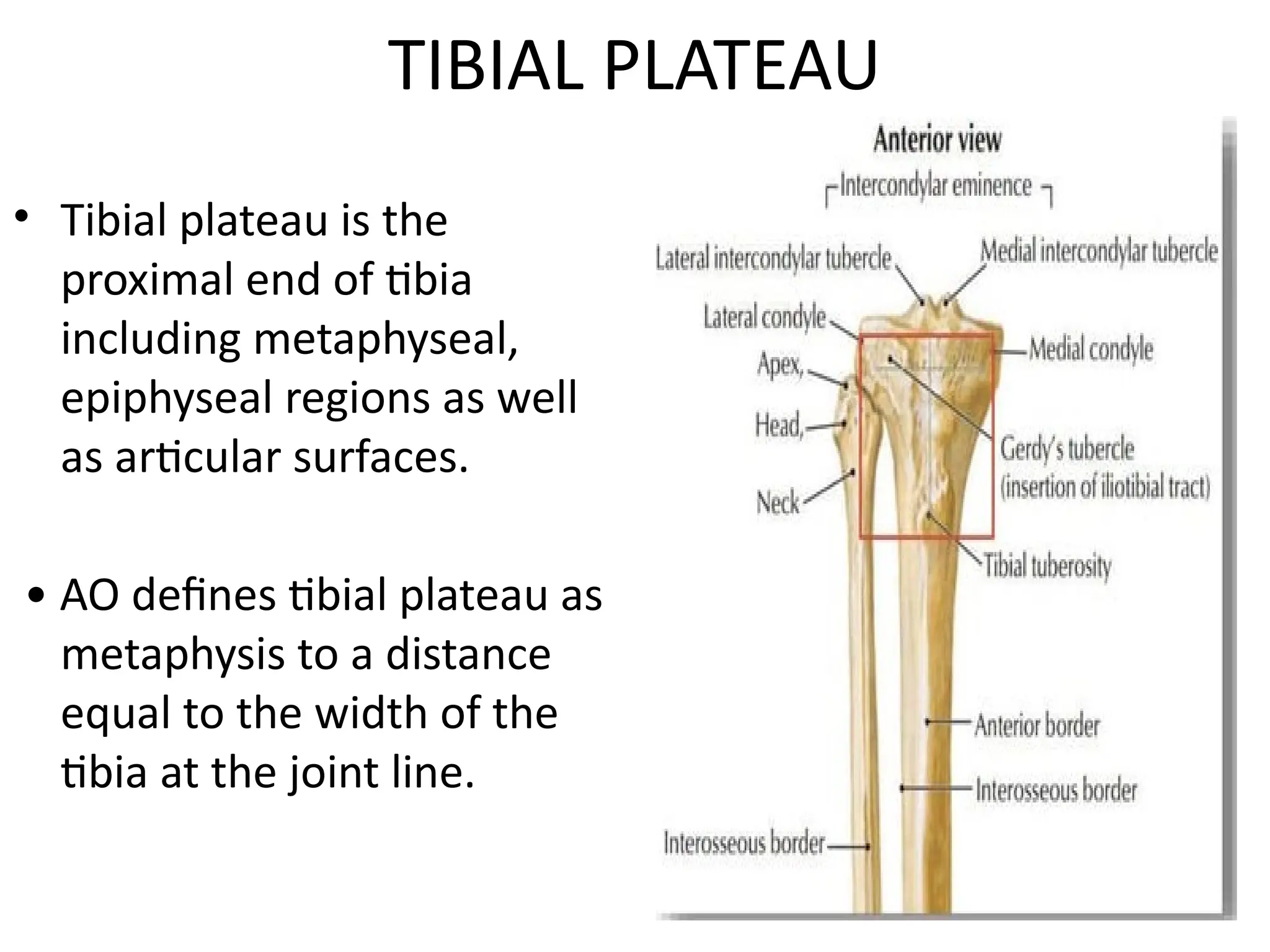 tibial plateau fracture and its management.pptx