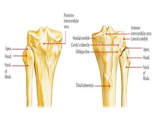 tibial plateau fracture and its management.pptx