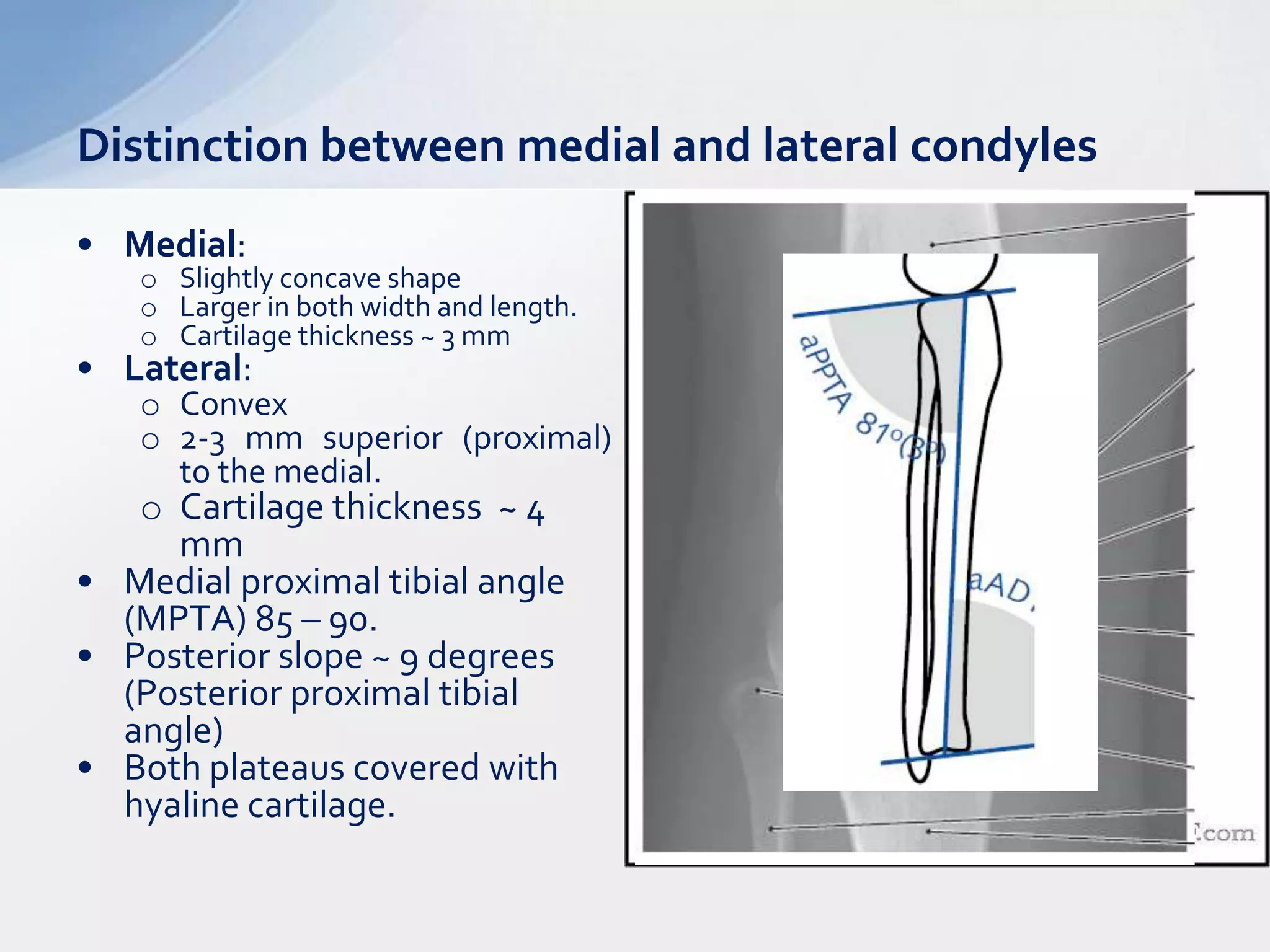 Tibial plateau fractures | PPTX