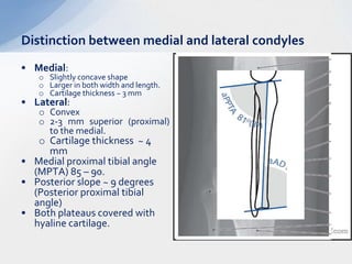 Tibial plateau fractures | PPTX
