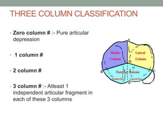 Tibial plateau fractures | PPTX