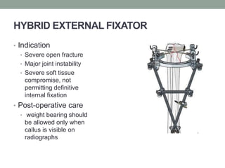 Tibial plateau fractures | PPT