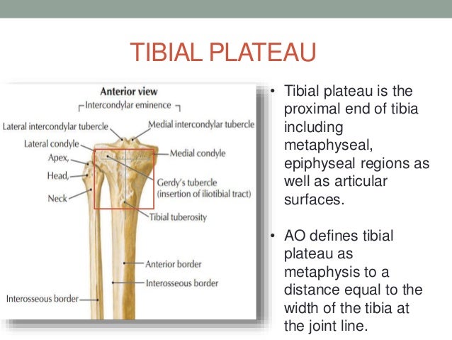 Tibial plateau fractures