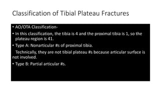 Tibial plateau fractures | PPTX