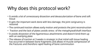 Tibial plateau treatment protocol SCH-1.pptx