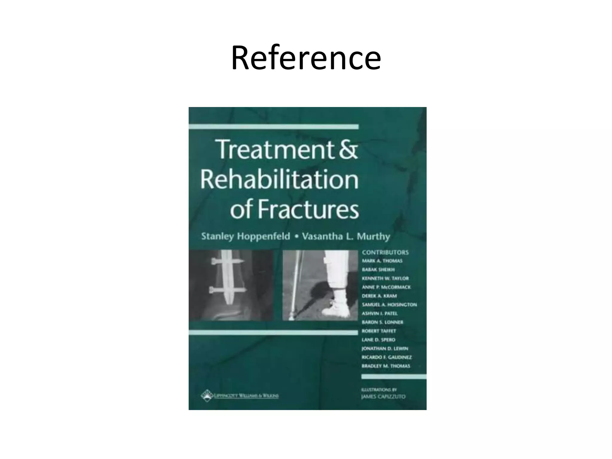 Tibial shaft fractures rehabilitation | PPTX