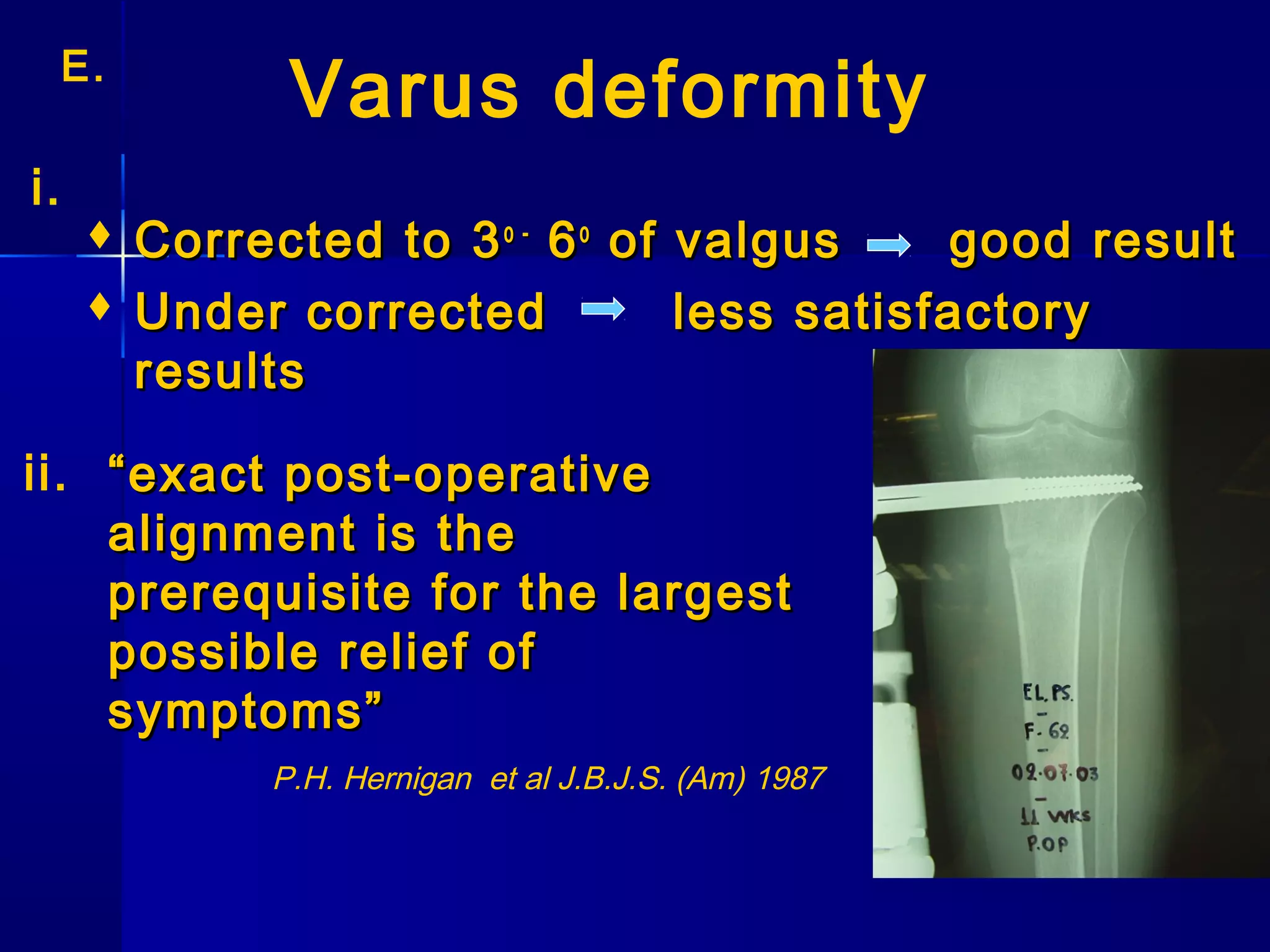 Upper tibial valgus osteotomy using a dynamic external fixator | PPT