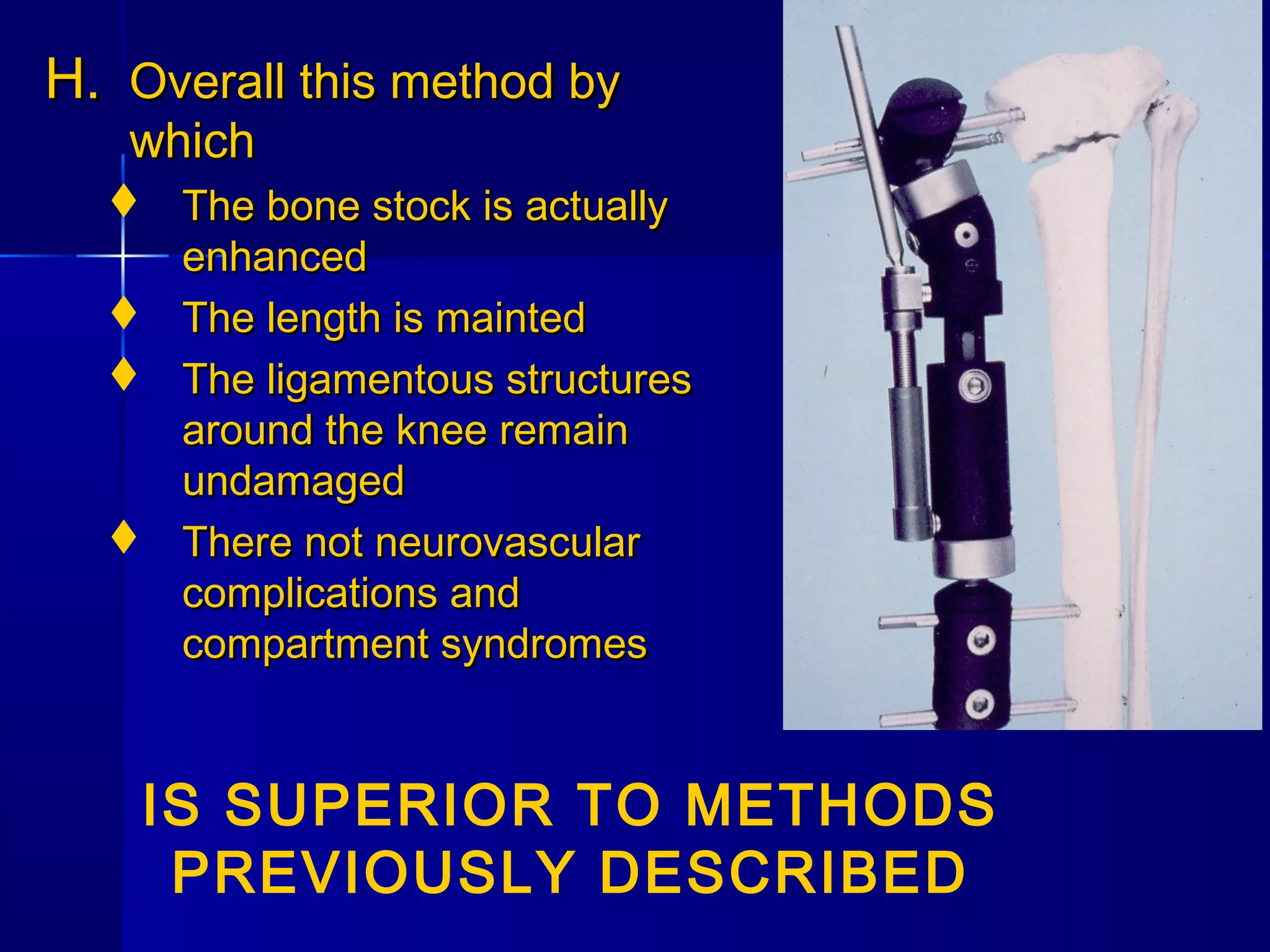 Upper tibial valgus osteotomy using a dynamic external fixator | PPT