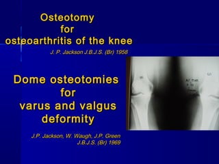Upper tibial valgus osteotomy using a dynamic external fixator | PPT