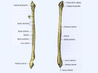 Perone Hueso
