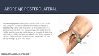fracturas meseta tibial y tibia proximal.pptx