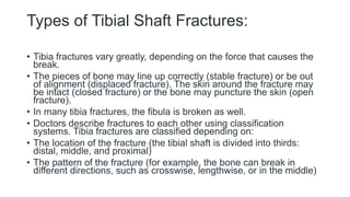 Tibia (Shinbone) Shaft Fractures.pptx