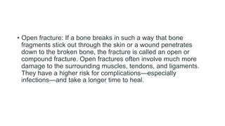 Tibia (Shinbone) Shaft Fractures.pptx