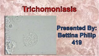 Trichomoniasis | PPTX