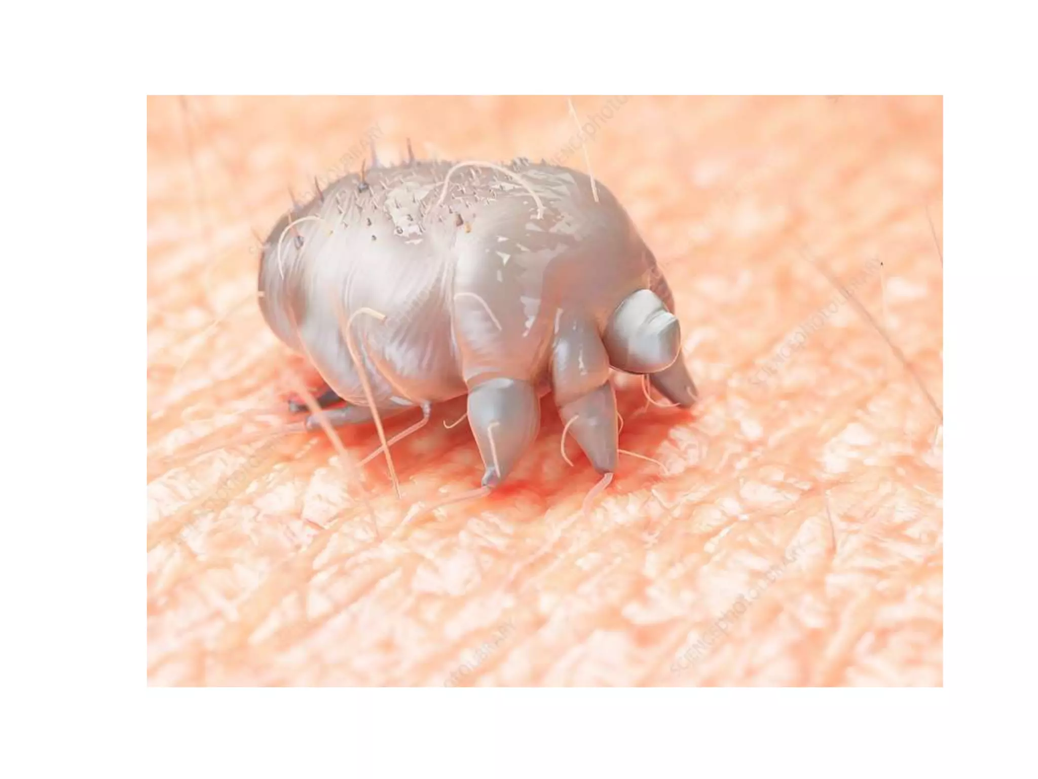 Ticks & Mites | PPTX