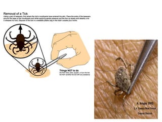 Tick and Lice.ppt | Infectious Diseases | Diseases and Conditions